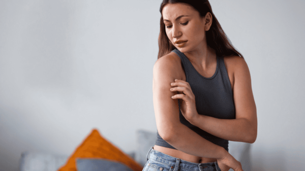 Mounjaro Injection Site Reaction: Symptoms, Causes & Treatment